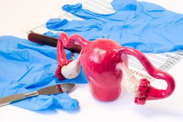 Histerektomia - co to jest i jakie są jej rodzaje? - Krok do Zdrowia