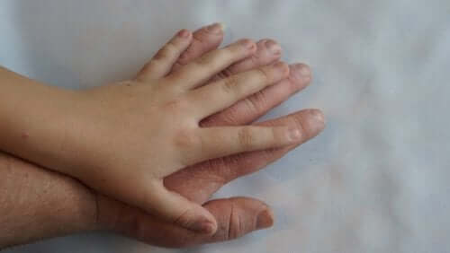 Akromegalia: co to jest i jakie są jej objawy - Krok do Zdrowia